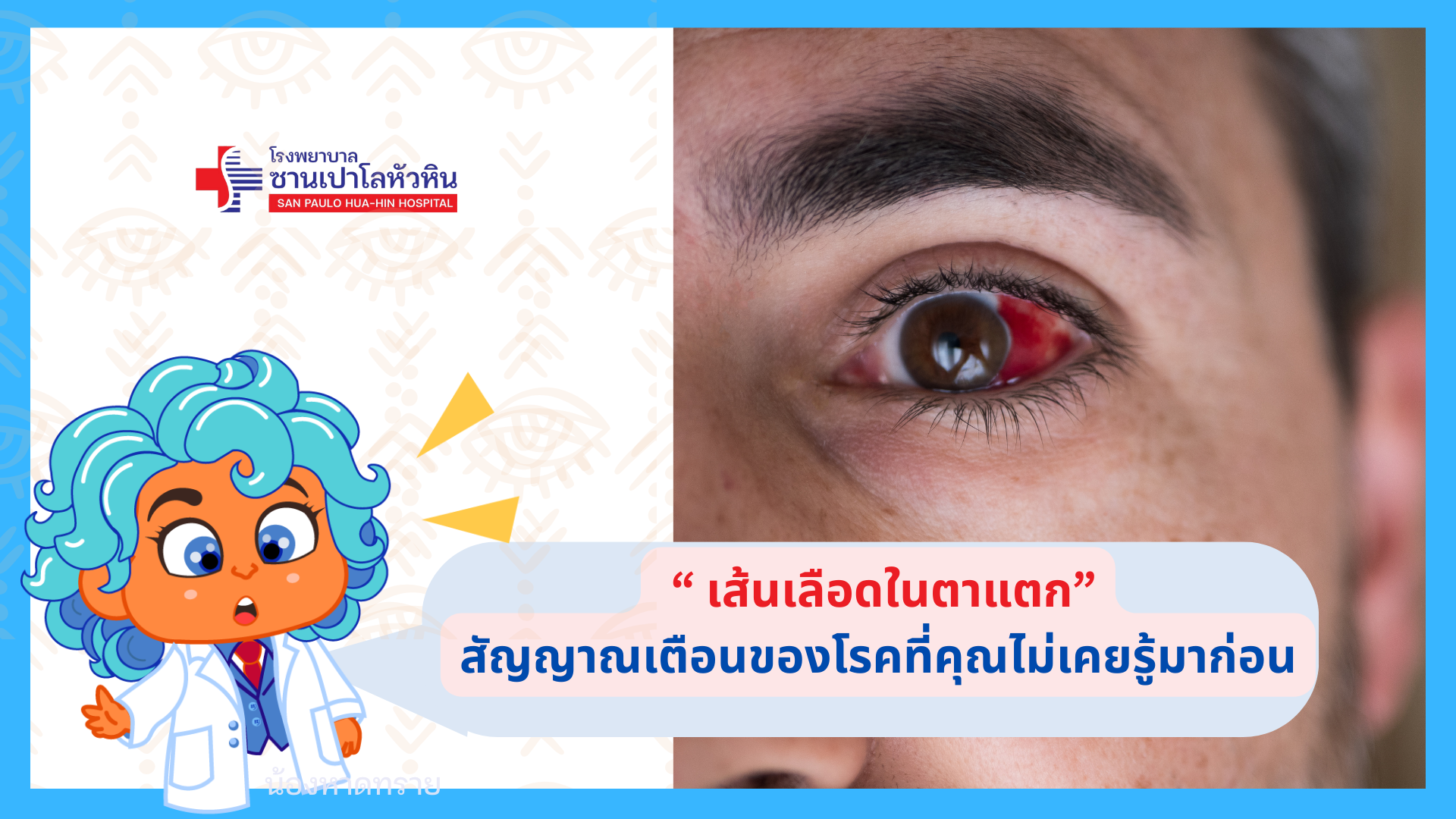 รู้ไหมว่า “เส้นเลือดในตาแตก” อาจเป็นสัญญาณเตือนของโรคที่คูณไม่เคยรู้มา ...